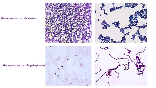Basic staining procedures in Microbiology | PPTX
