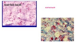 Basic staining procedures in Microbiology | PPTX