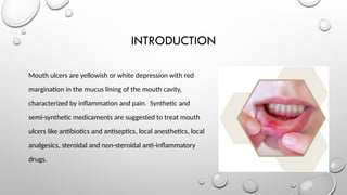 Formulation and evaluation of gel Mouth ulcer management | PPT