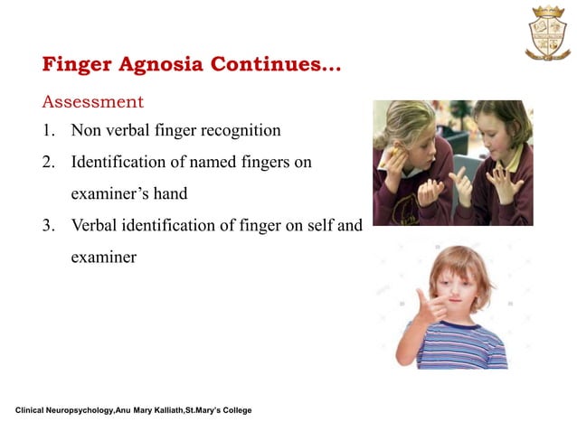 Psychology-Body Scheme Disturbances | PPTX