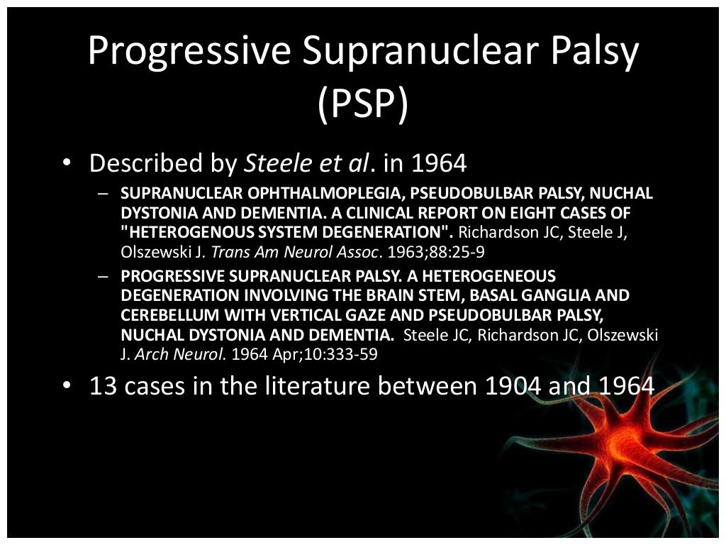 A Case of Progressive Supranuclear Palsy