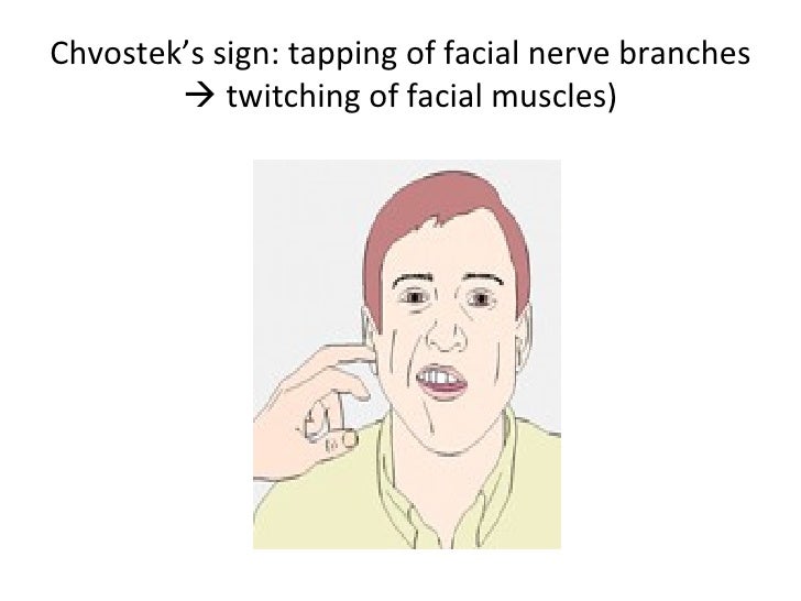 An Unusual case of Tetany