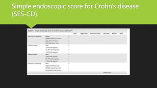 An Update in the management of Crohn’s disease | PPTX