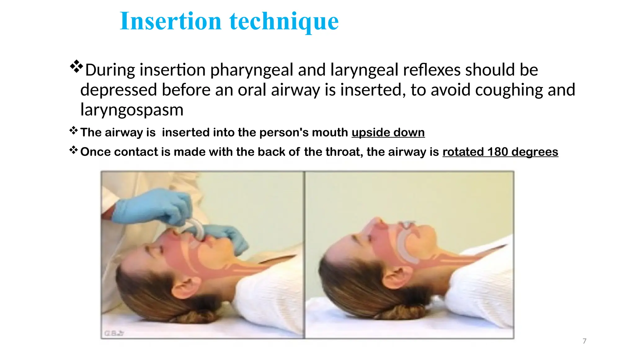 Airway equipments for senior and junior resident | PPTX
