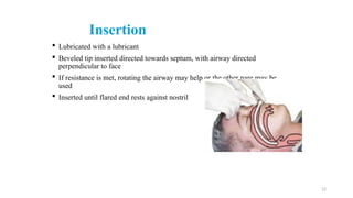 Airway equipments for senior and junior resident | PPTX