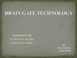 brain gate technology | PPT