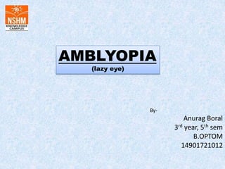 Amblyopia | PPTX