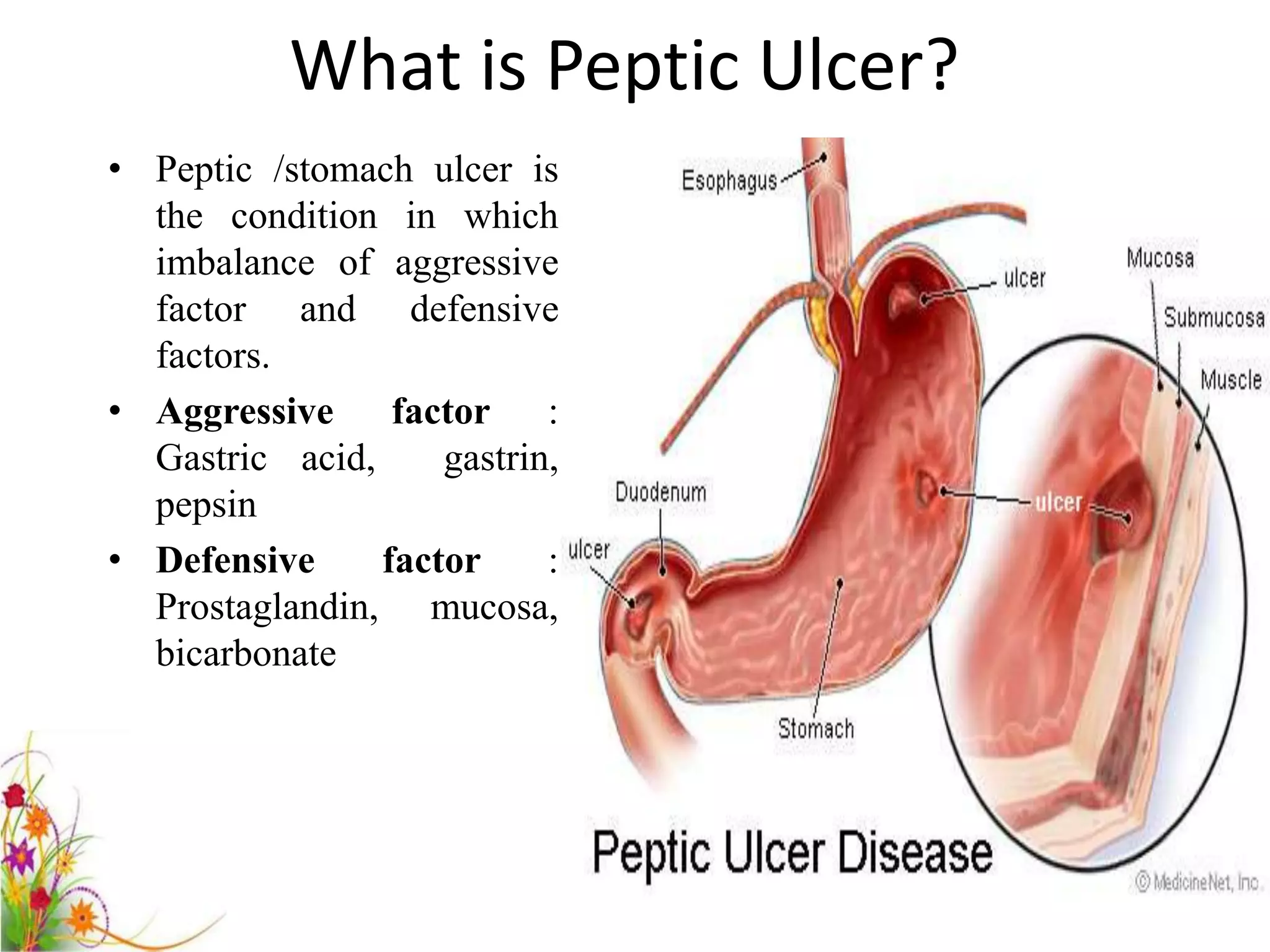 anti ulcer drugs | PPTX
