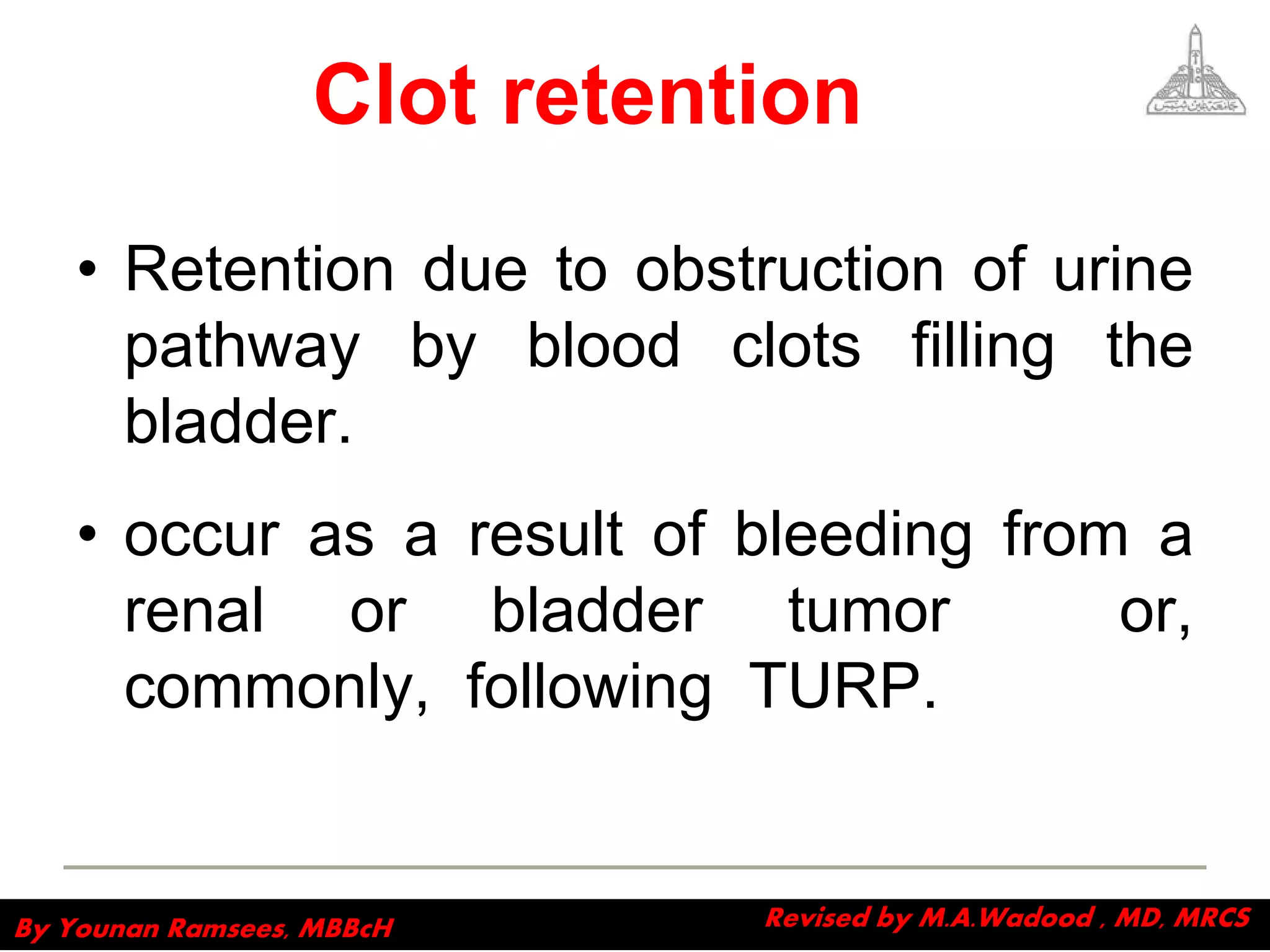 Anuria & acute retention | PDF