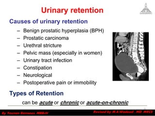 Anuria & acute retention | PDF