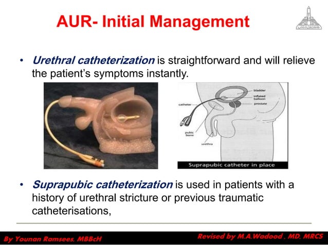 Anuria & acute retention | PDF