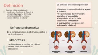 ANURIA EXCRETORIA catedra de urologia.pptx