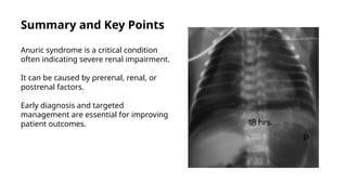 Anuric Syndrome treatment and causes and effects | PPTX