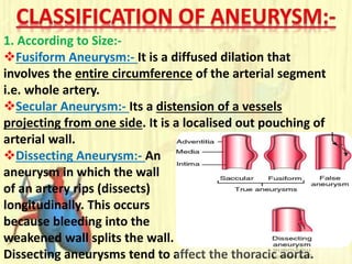 Aneurysm | PPTX