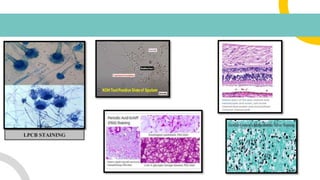 gram stainning | PPTX