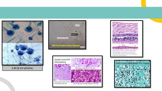 gram stainning | PPT