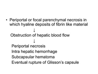 Pregnancy Induced Hypertension- Pathophysiology | PPTX | Pregnancy ...