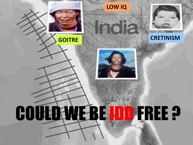 Current Status of IDD in India | PPT