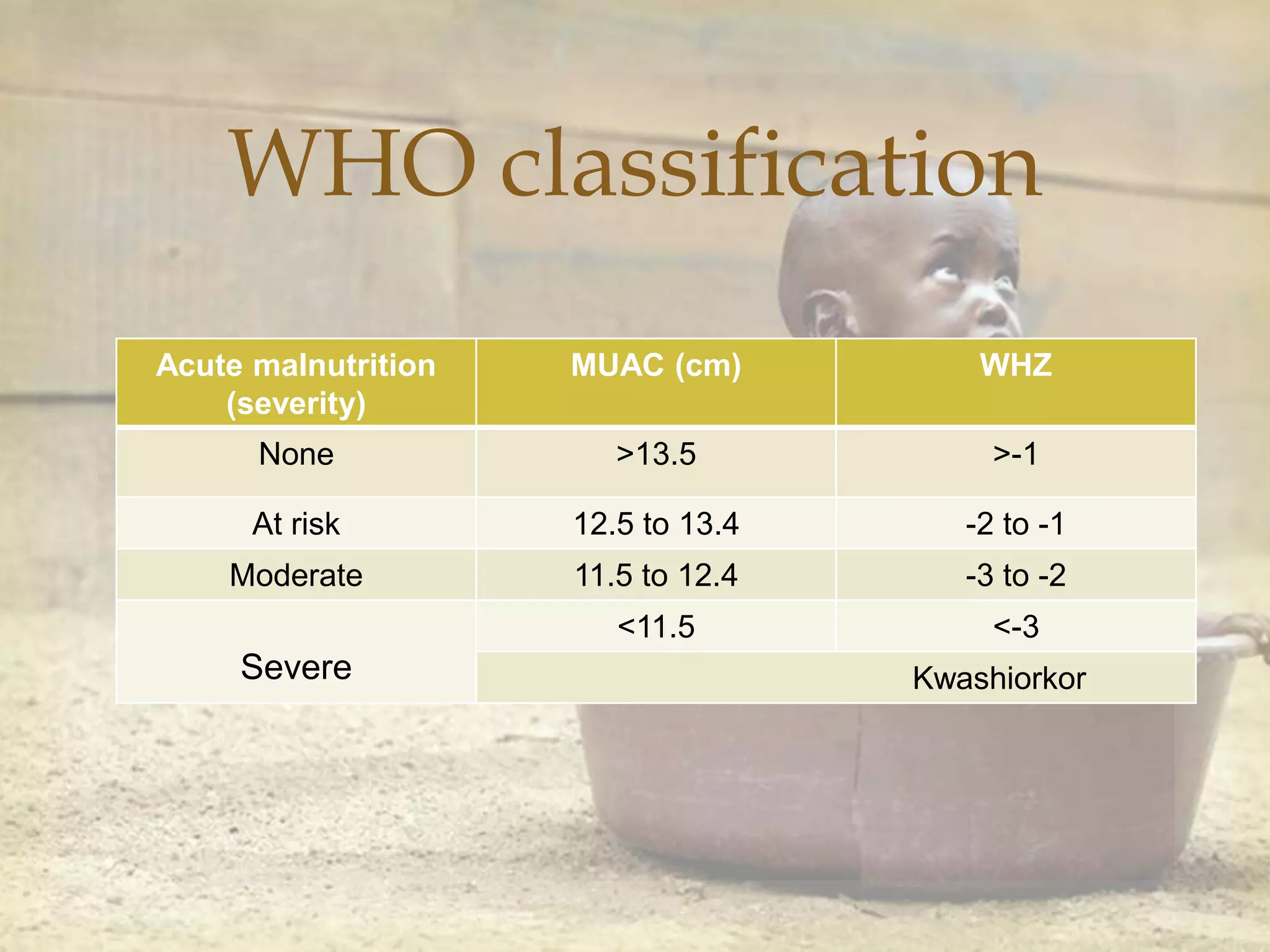 SEVERE ACUTE MALNUTRITION | PPTX