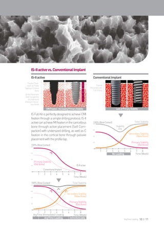 Neo Biotech IS-II Active Implant - Catalog | PDF