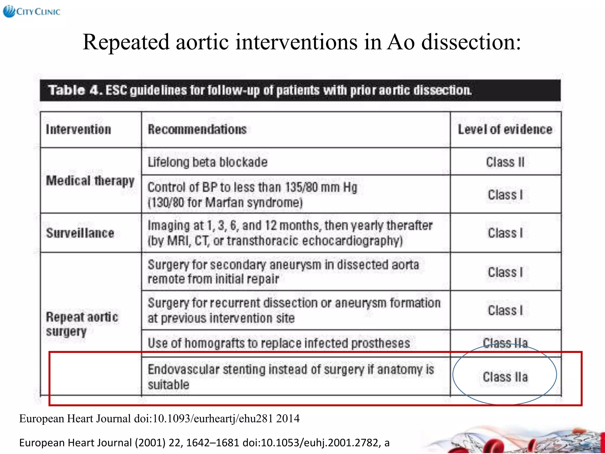 Centralization of flow in aortic dissection | PPT