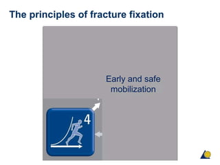 AO-Principles of fracture fixation .pptx
