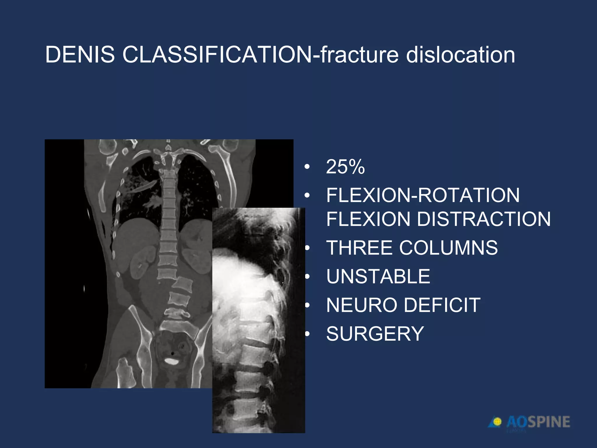 AO-TOMAR-THORACIC.ppsx