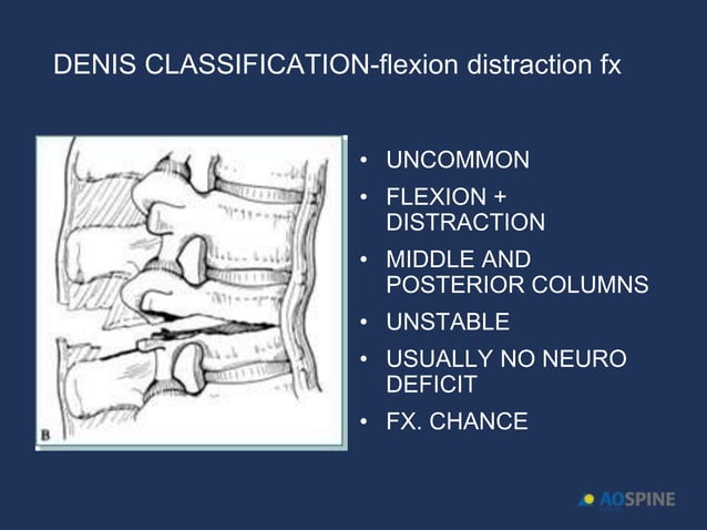 AO-TOMAR-THORACIC.ppsx