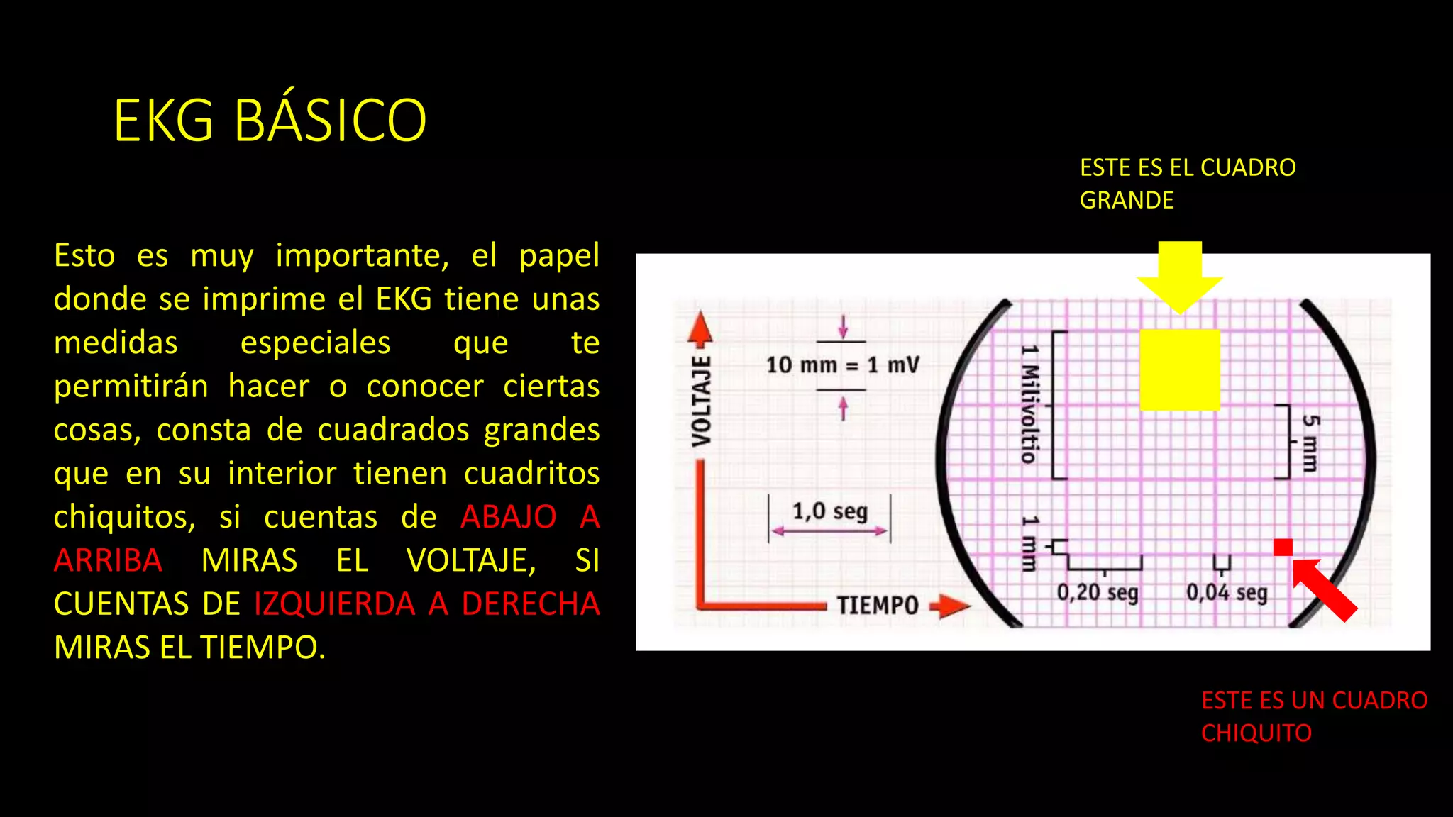 EKG básico y alteraciones electrocardiográficas, guía rápida para ...