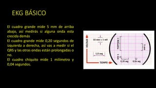 EKG básico y alteraciones electrocardiográficas, guía rápida para ...