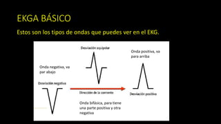EKG básico y alteraciones electrocardiográficas, guía rápida para ...