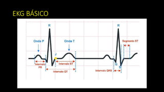 EKG básico y alteraciones electrocardiográficas, guía rápida para ...