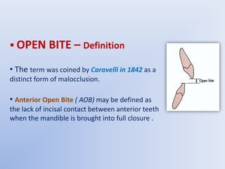 Anterior Open Bite etiology and differential diagnosis | PDF