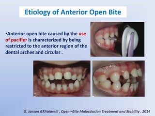 Anterior Open Bite etiology and differential diagnosis | PDF
