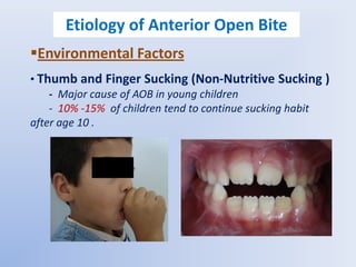 Anterior Open Bite etiology and differential diagnosis | PDF