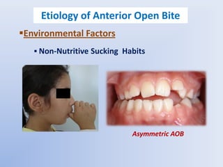 Anterior Open Bite etiology and differential diagnosis | PDF