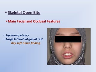 Anterior Open Bite etiology and differential diagnosis | PDF