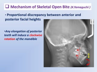Anterior Open Bite etiology and differential diagnosis | PDF