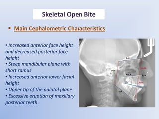 Anterior Open Bite etiology and differential diagnosis | PDF
