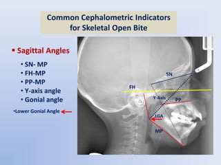 Anterior Open Bite etiology and differential diagnosis | PDF