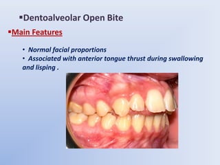 Anterior Open Bite etiology and differential diagnosis