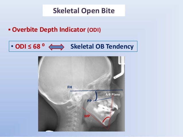 Anterior Open Bite etiology and differential diagnosis