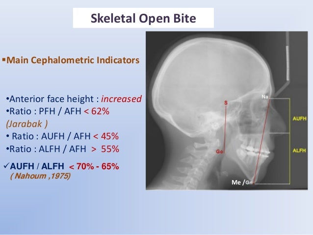 Aob etiology and differential diagnosis