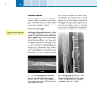 AO Book, Tech of reduction surrgical procedure | PDF