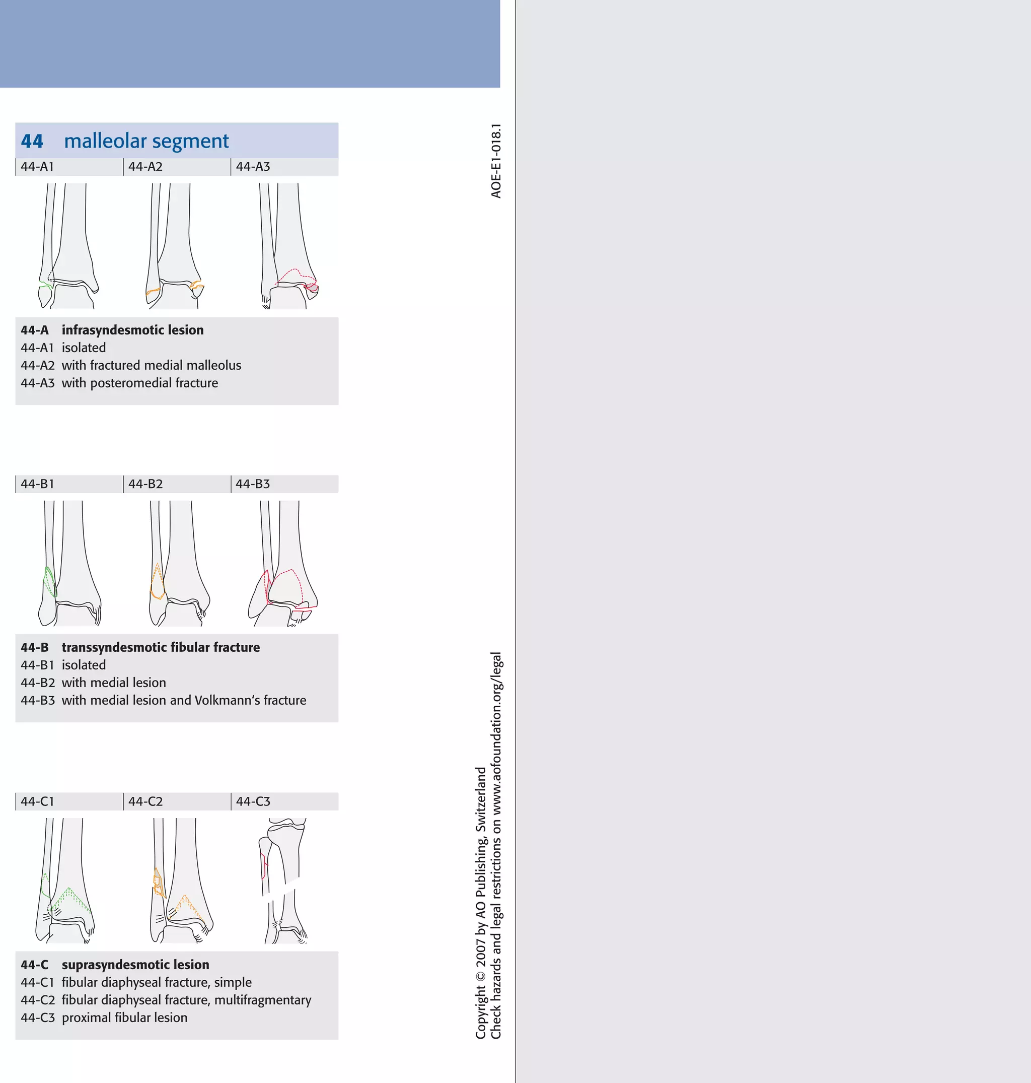 MULLER AO CLASSIFICATION | PDF