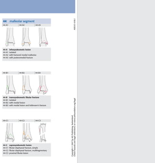 MULLER AO CLASSIFICATION | PDF