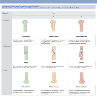 MULLER AO CLASSIFICATION