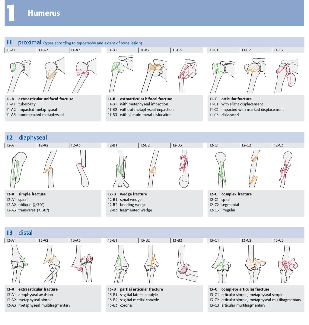 MULLER AO CLASSIFICATION