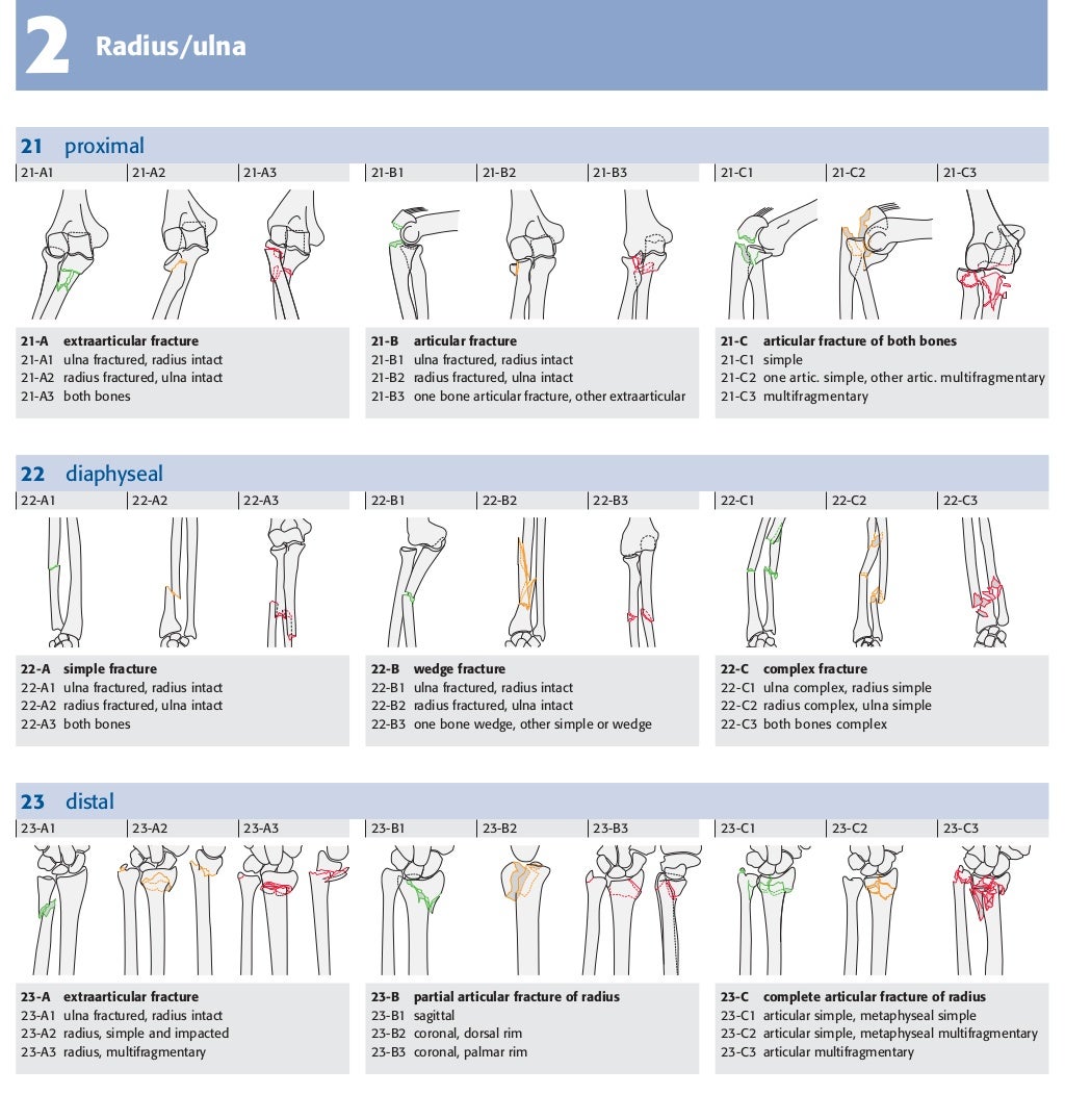 MULLER AO CLASSIFICATION