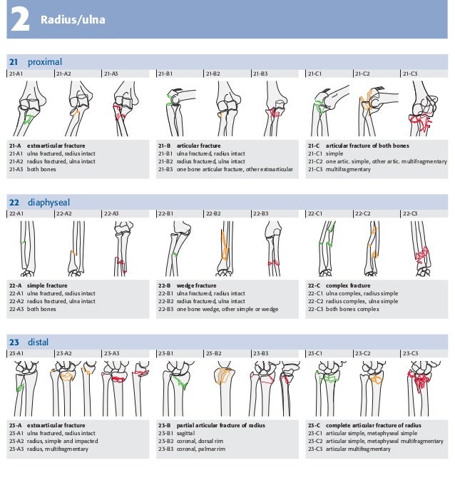 MULLER AO CLASSIFICATION
